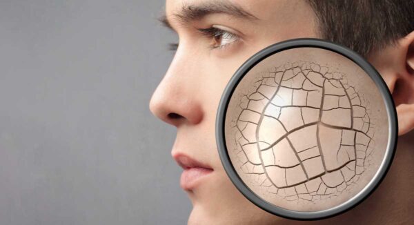 Dry vs. Dehydrated Skin | INOX